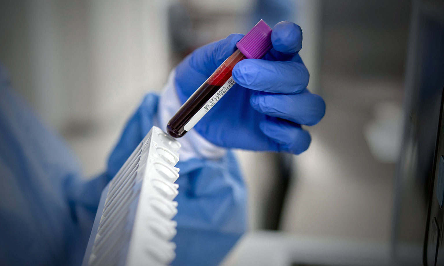 Otolaryngology Research Program | Icahn School of Medicine