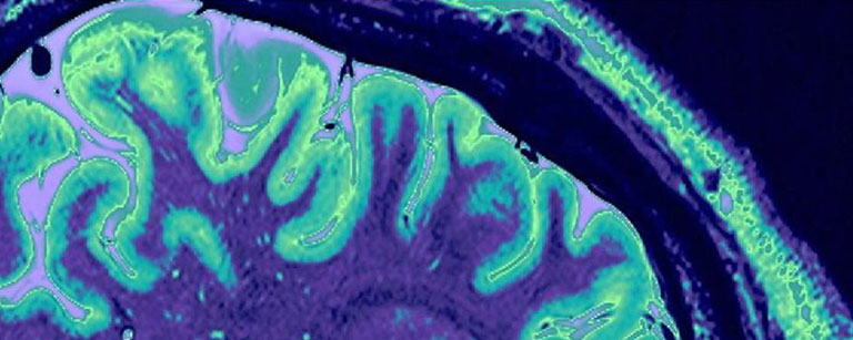 PhD Program in Neuroscience | Icahn School of Medicine