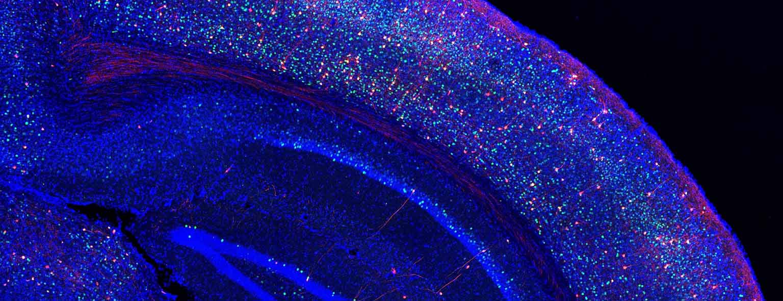 Neuroscience PhD Program Laboratories | Icahn School of Medicine