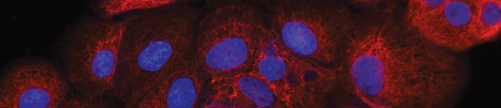 Brain Stem Cell Research | Icahn School of Medicine