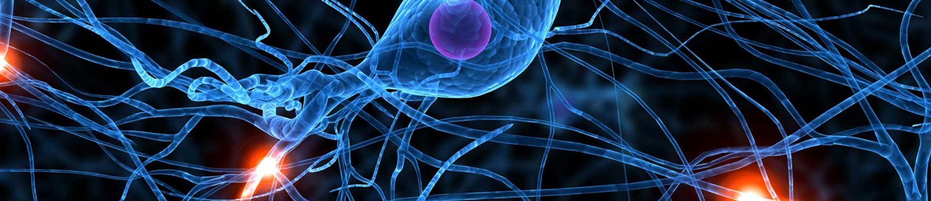 Alzheimer's Disease Research | Icahn School of Medicine