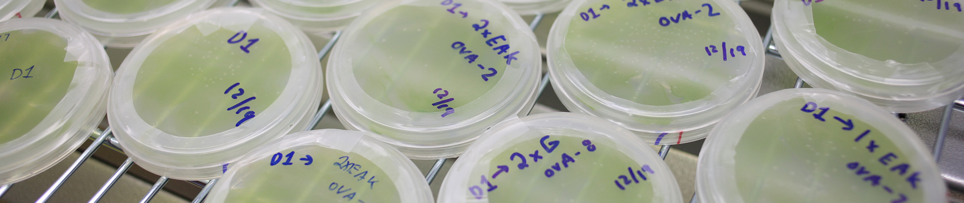 Scientific Highlights - Jaffe Food Allergy | Icahn School of Medicine