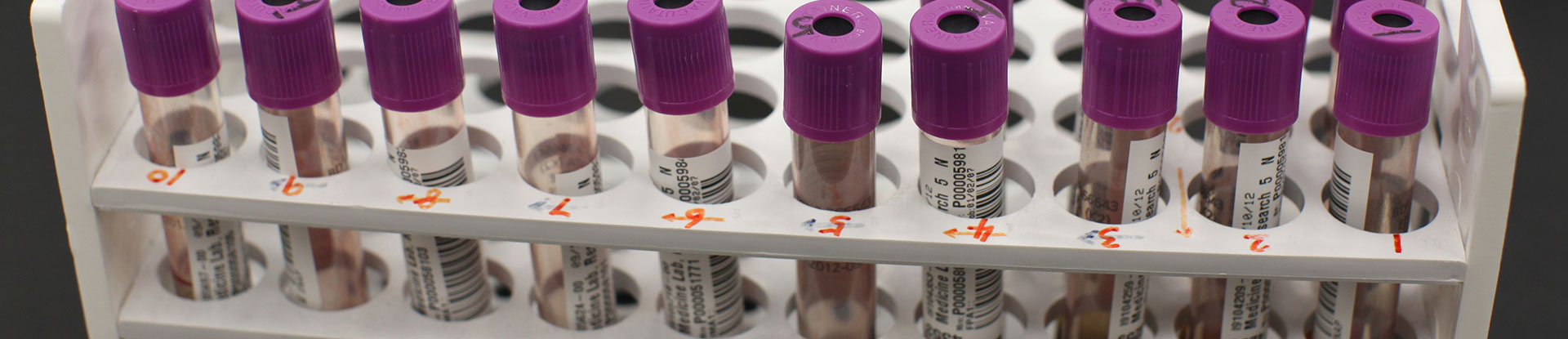 BioMe BioBank Program | Icahn School of Medicine