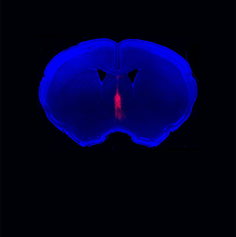 Affective Neuroscience Research | Icahn School of Medicine