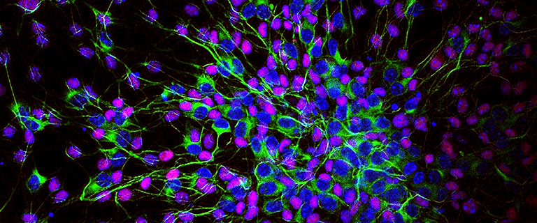 Brain-Body Research Institute | Icahn School of Medicine