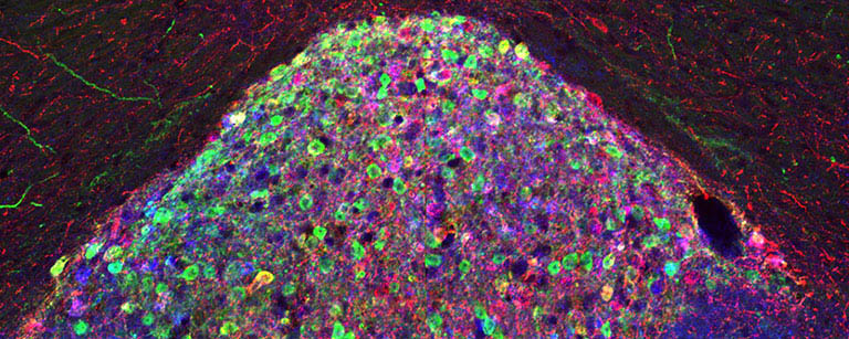 Brain-Body Research Institute | Icahn School of Medicine