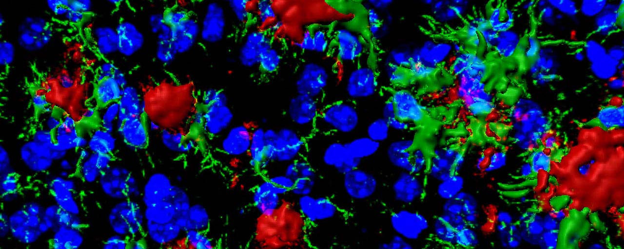 Brain-Body Research Institute | Icahn School of Medicine