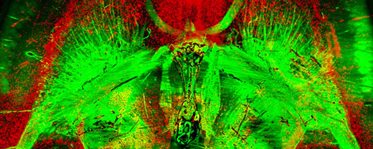 Brain-Body Research Institute | Icahn School of Medicine