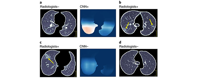 Brain and Body Research Laboratories | Icahn School of Medicine