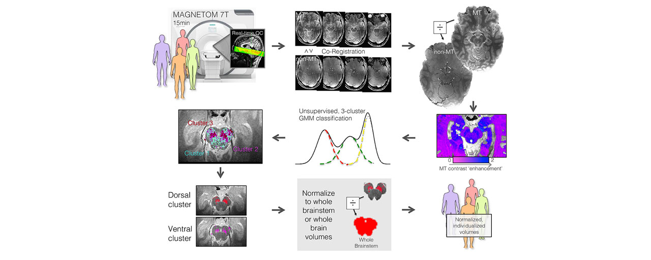 Brain and Body Research Laboratories | Icahn School of Medicine