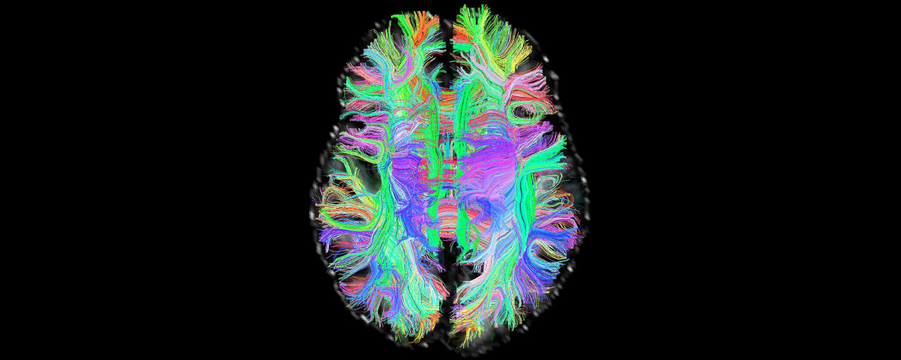 Brain and Body Research Laboratories | Icahn School of Medicine