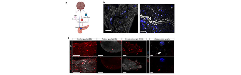 Brain and Body Research Areas | Icahn School of Medicine