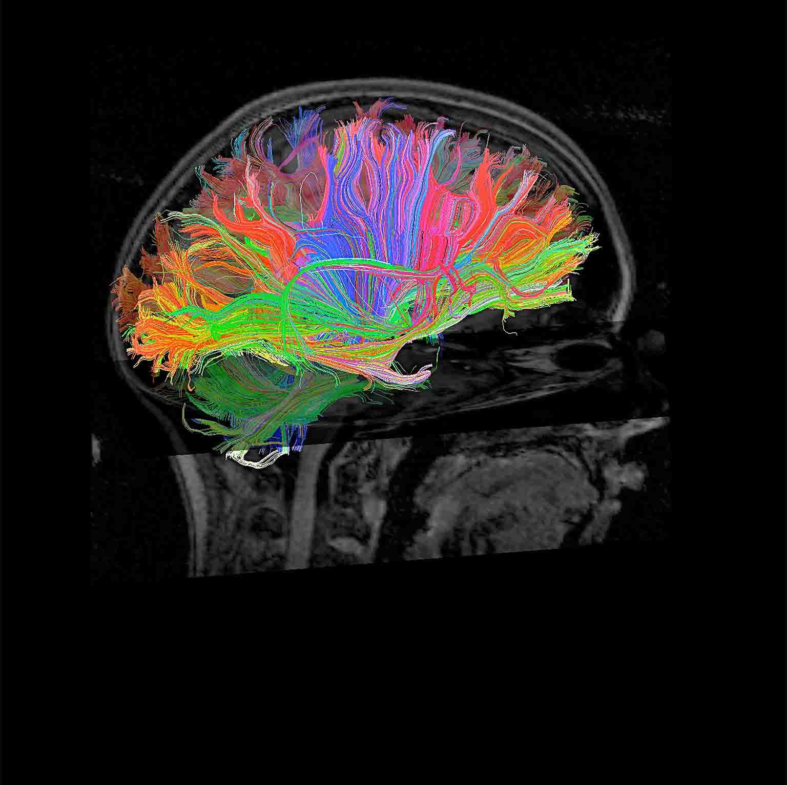 Brain and Body Research Areas | Icahn School of Medicine