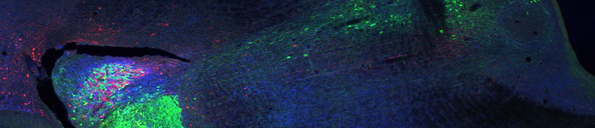 Stress and Trauma | Icahn School of Medicine