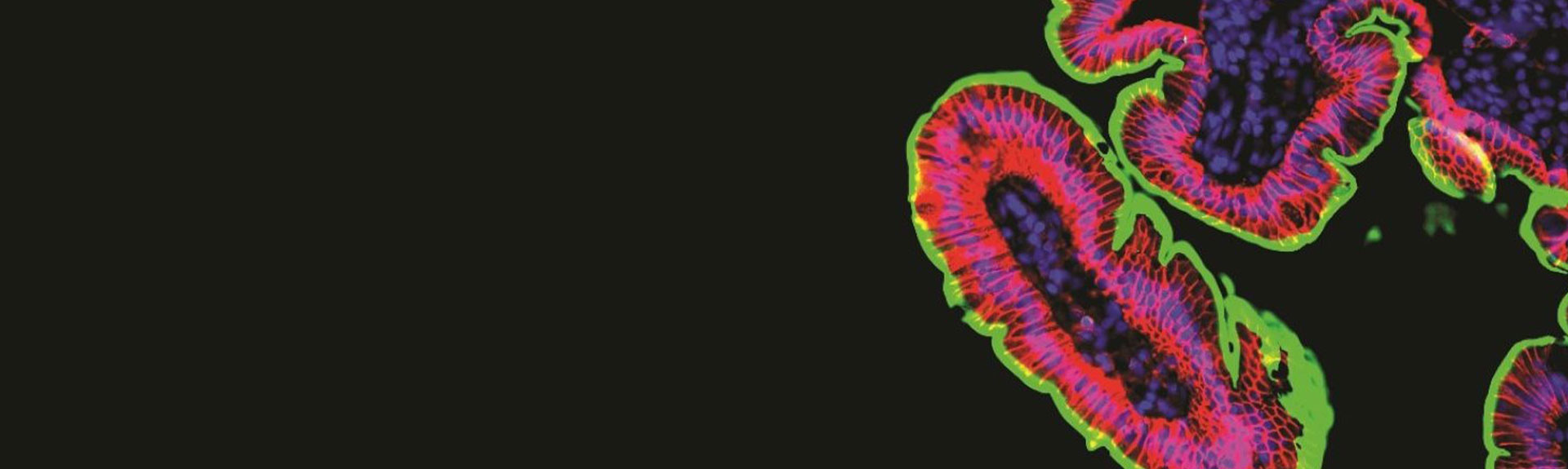 Marc and Jennifer Lipschultz Precision Immunology Institute | Icahn ...