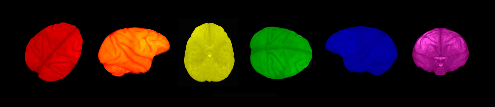 Lipschultz Center for Cognitive Neuroscience | Icahn School of Medicine