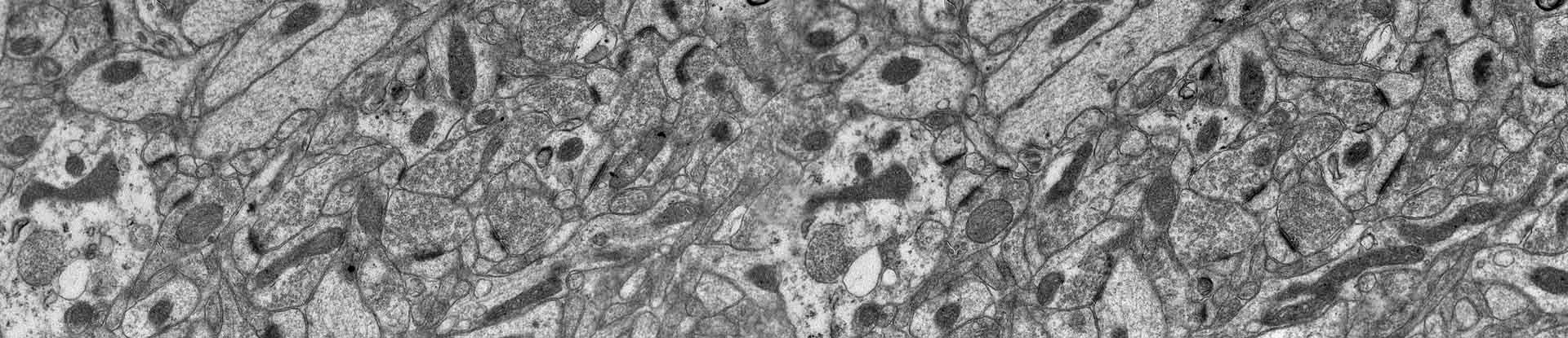 Lipschultz Center for Cognitive Neuroscience | Icahn School of Medicine