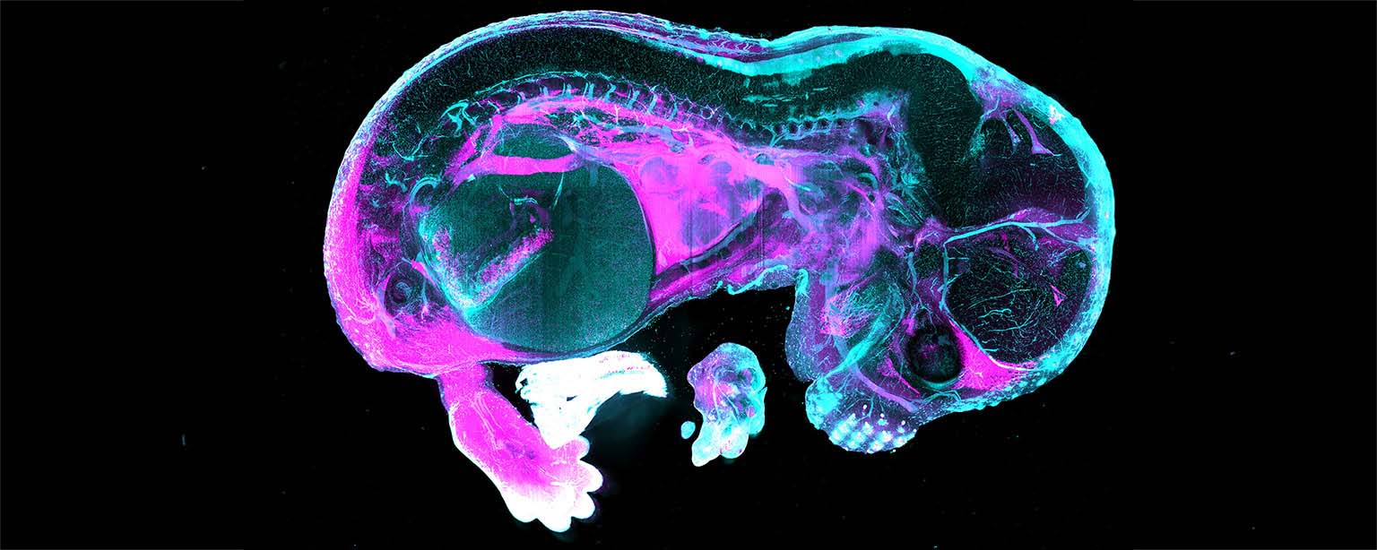 Microscopy and Advanced Bioimaging CoRE | Icahn School of Medicine
